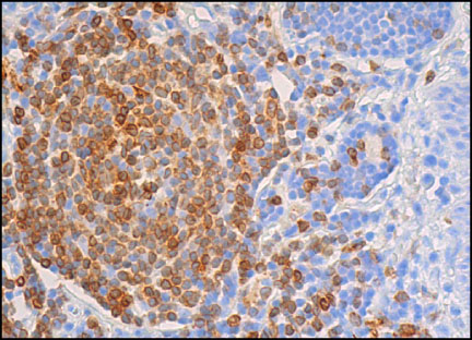 BioSynTech Malaysia Group Sdn Bhd | Santa Cruz New Direct HRP Conjugate ...