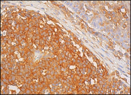 BioSynTech Malaysia Group Sdn Bhd | Santa Cruz New Direct HRP Conjugate ...