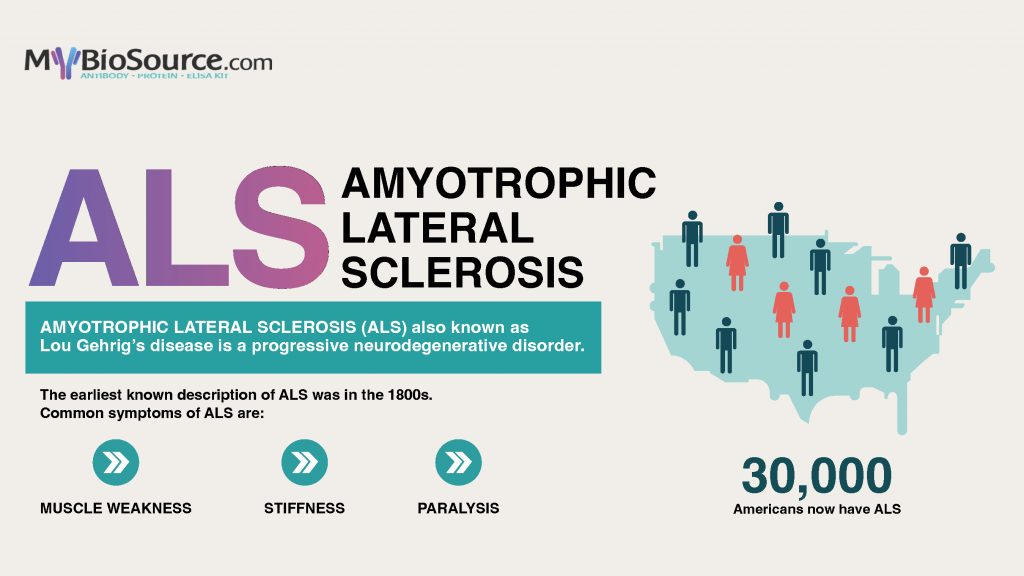 BioSynTech Malaysia Group Sdn Bhd | MYBIOSOURCE | ALS (Amyotrophic ...